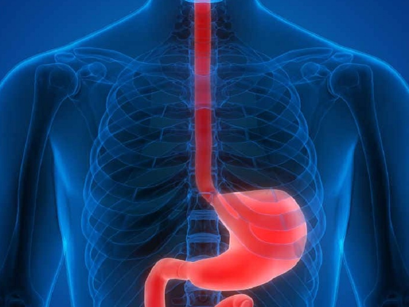 Esofagite eosinofila: nei bambini benefici da uso di dupilumab ...